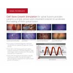 DJO External Bone Growth Stimulator - Gateway Medical Equipment